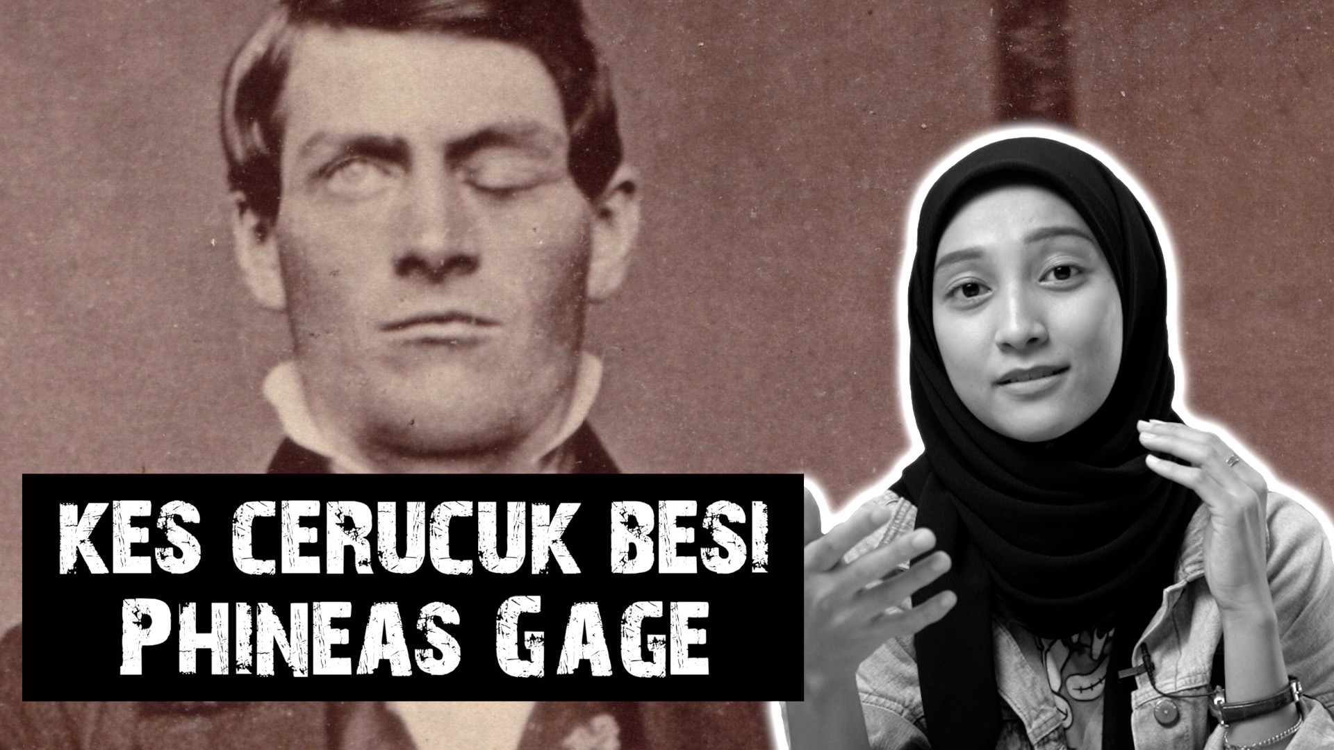 Kes Cerucuk Besi Phineas Gage – ML Studios