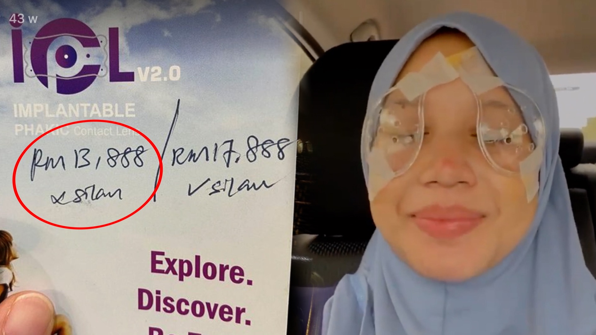 Pengalaman Bedah Mata Berharga 14 Ribu – ML Studios