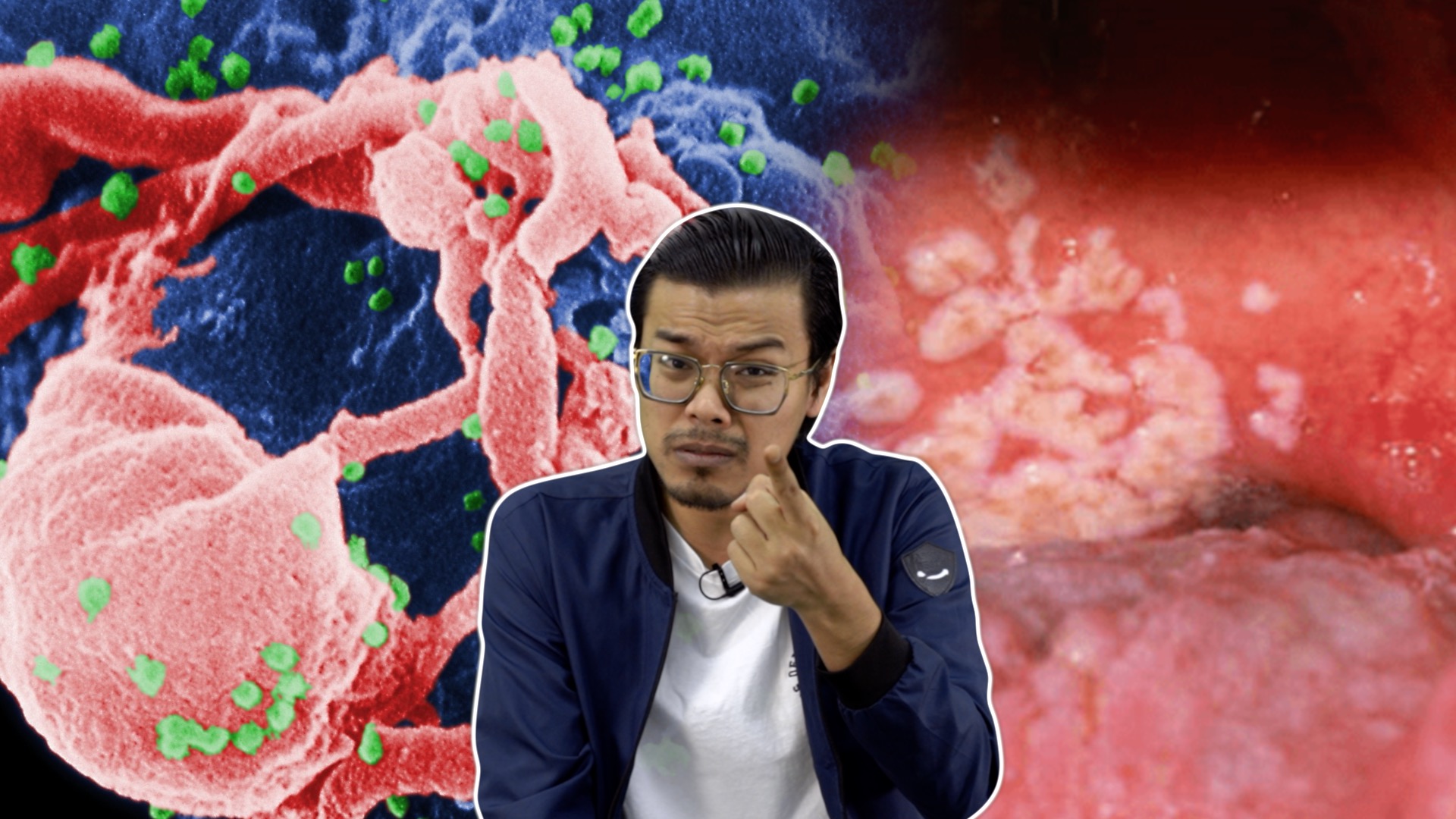 Bagaimana HIV Tersebar dan Apa Nak Buat Kalau Terkena? – ML Studios